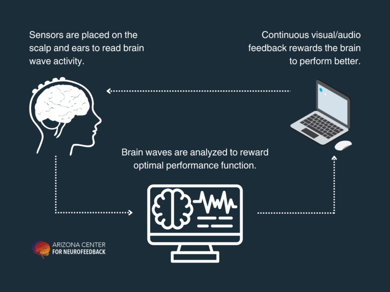 How Does Neurofeedback Work for Anxiety?
